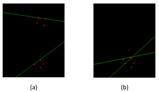 Localization and Edge-Based Segmentation of Lumbar Spine Vertebrae to ...