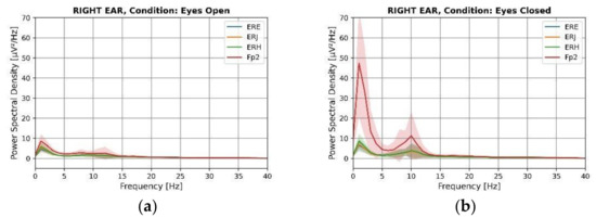 Advancing towards Ubiquitous EEG, Correlation of In-Ear EEG with ...
