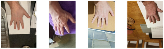 Ensemble-Based Bounding Box Regression for Enhanced Knuckle Localization