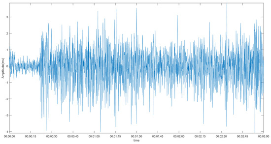Sensors Free Full Text Discussion Of The Influence Of Multiscale Pca Denoising Methods With