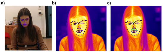 Automated Affective Computing Based on Bio-Signals Analysis and Deep ...