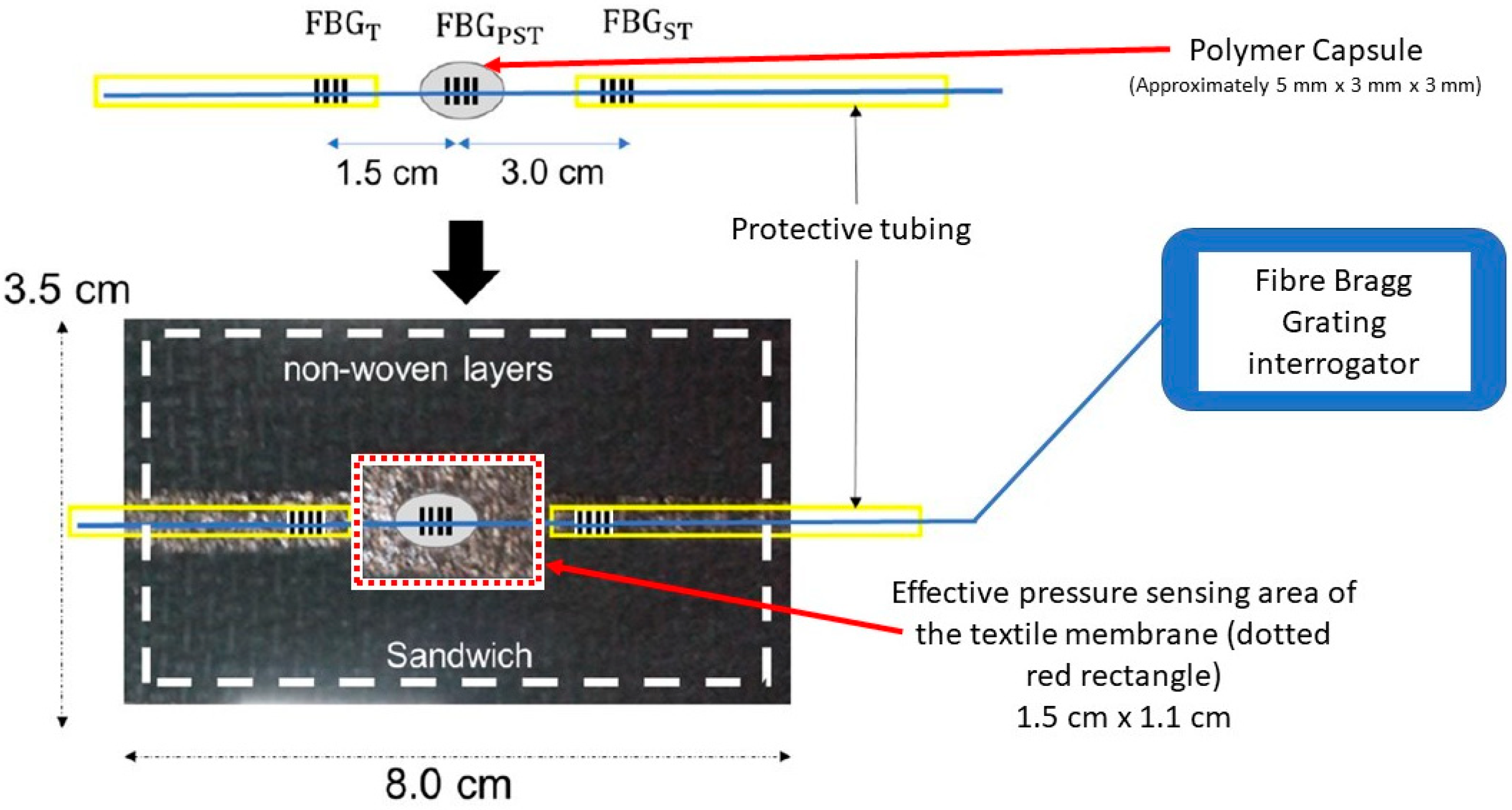 Fibre Bragg Grating Based Interface Pressure Sensor for Compression Therapy