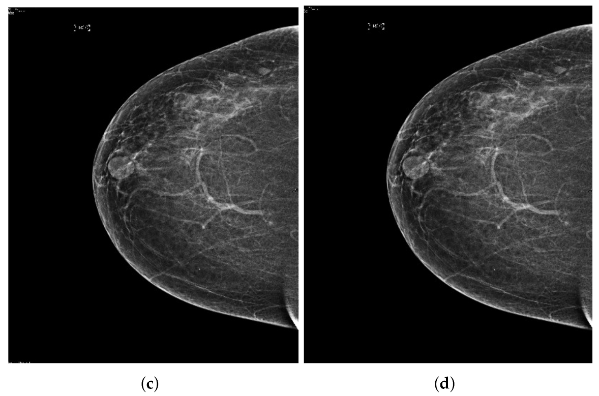 Sensors | Free Full-Text | Impact of Image Enhancement Module for ...