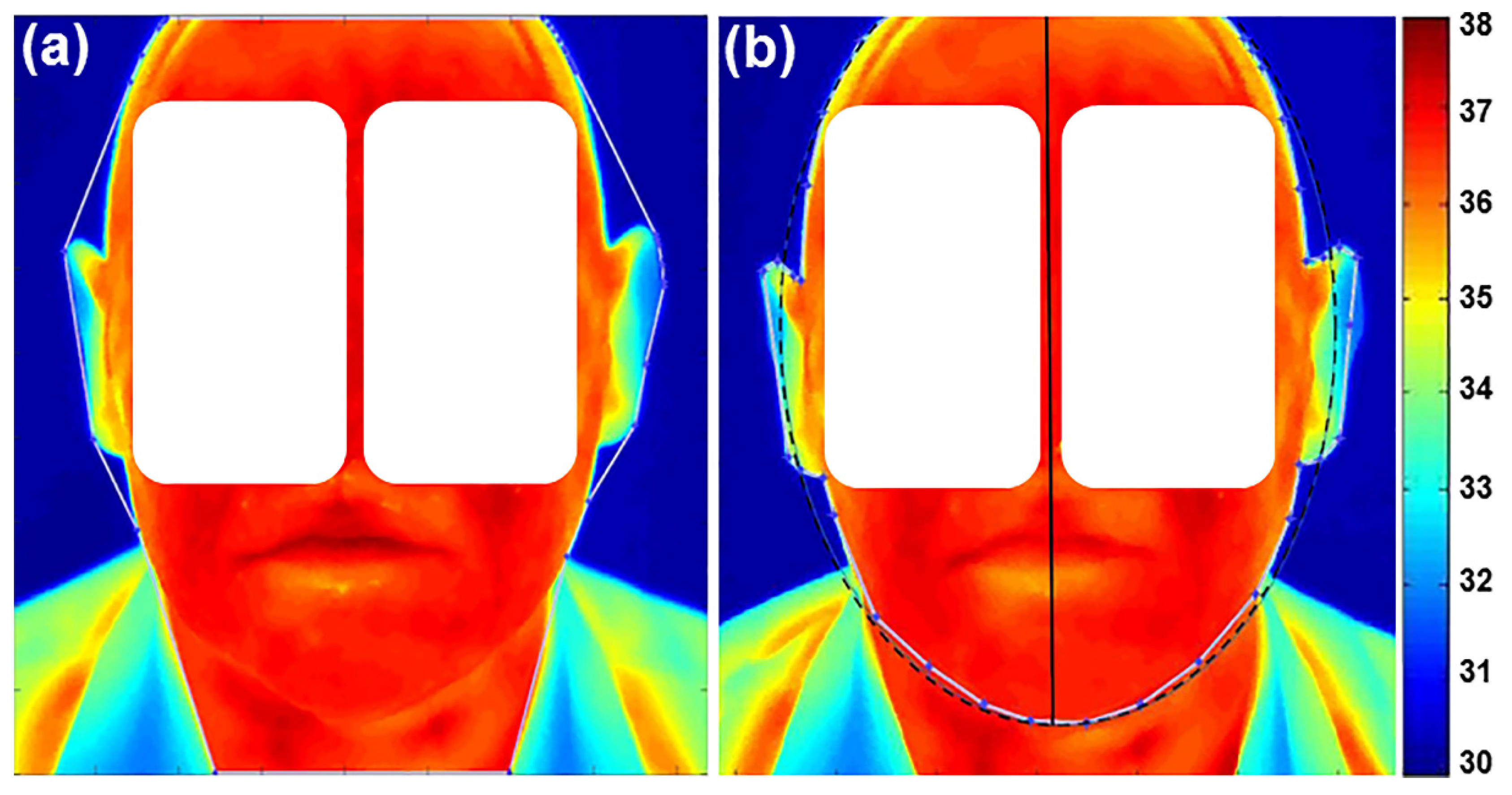 Automatic Detection of Human Maxillofacial Tumors by Using Thermal ...