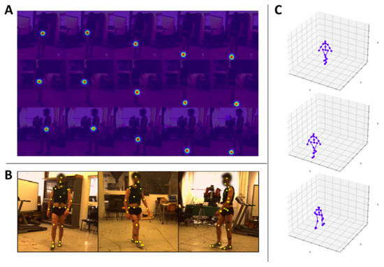 Markerless vs. Marker-Based Gait Analysis: A Proof of Concept Study