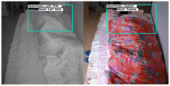 A Vision-Based System for In-Sleep Upper-Body and Head Pose Classification