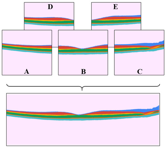 OCT Retinal and Choroidal Layer Instance Segmentation Using Mask R-CNN