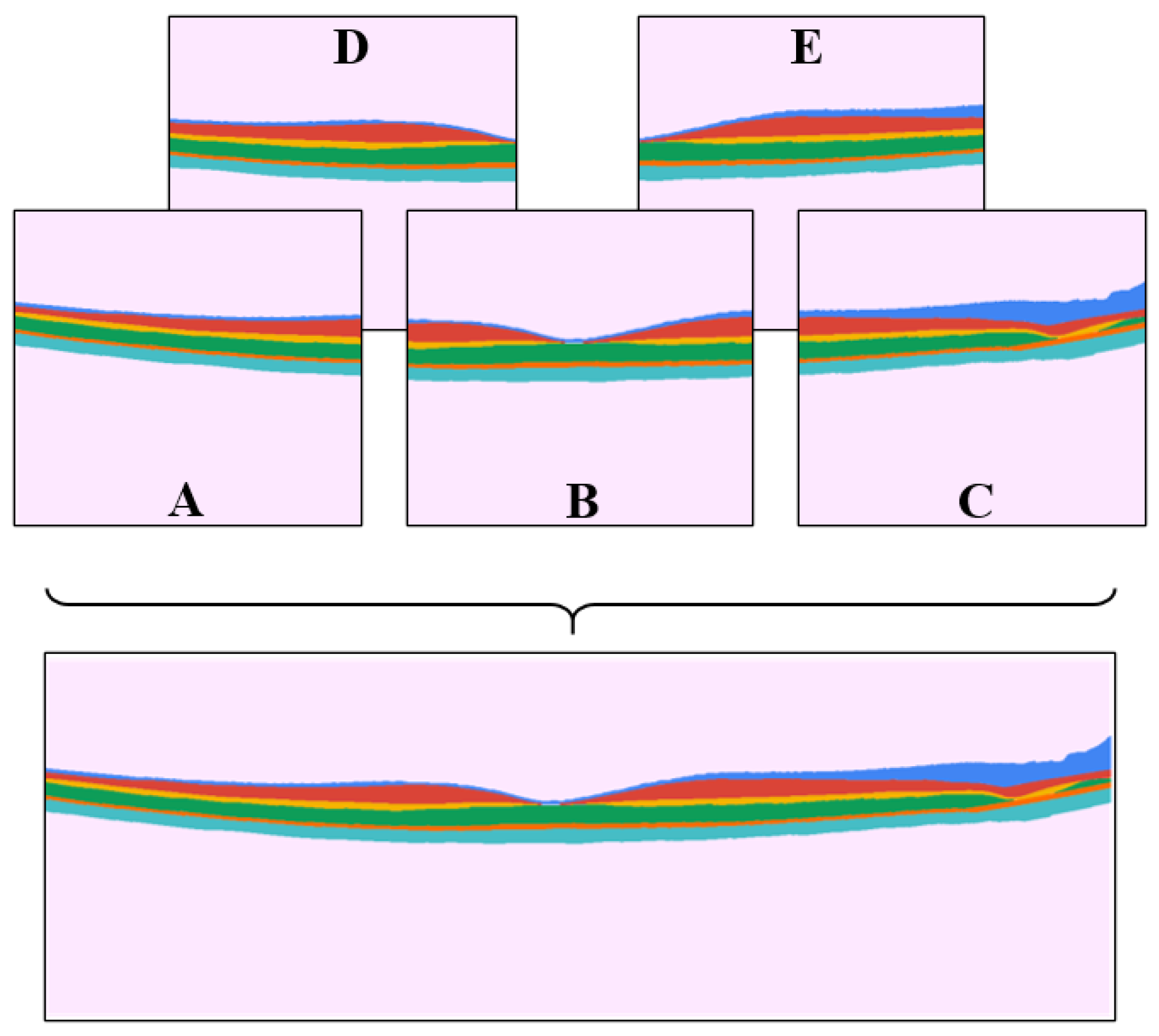 Sensors | Free Full-Text | OCT Retinal and Choroidal Layer Instance Segmentation Using Mask R-CNN