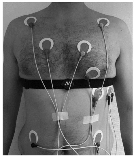 The Movesense Medical Sensor Chest Belt Device as Single Channel ECG ...