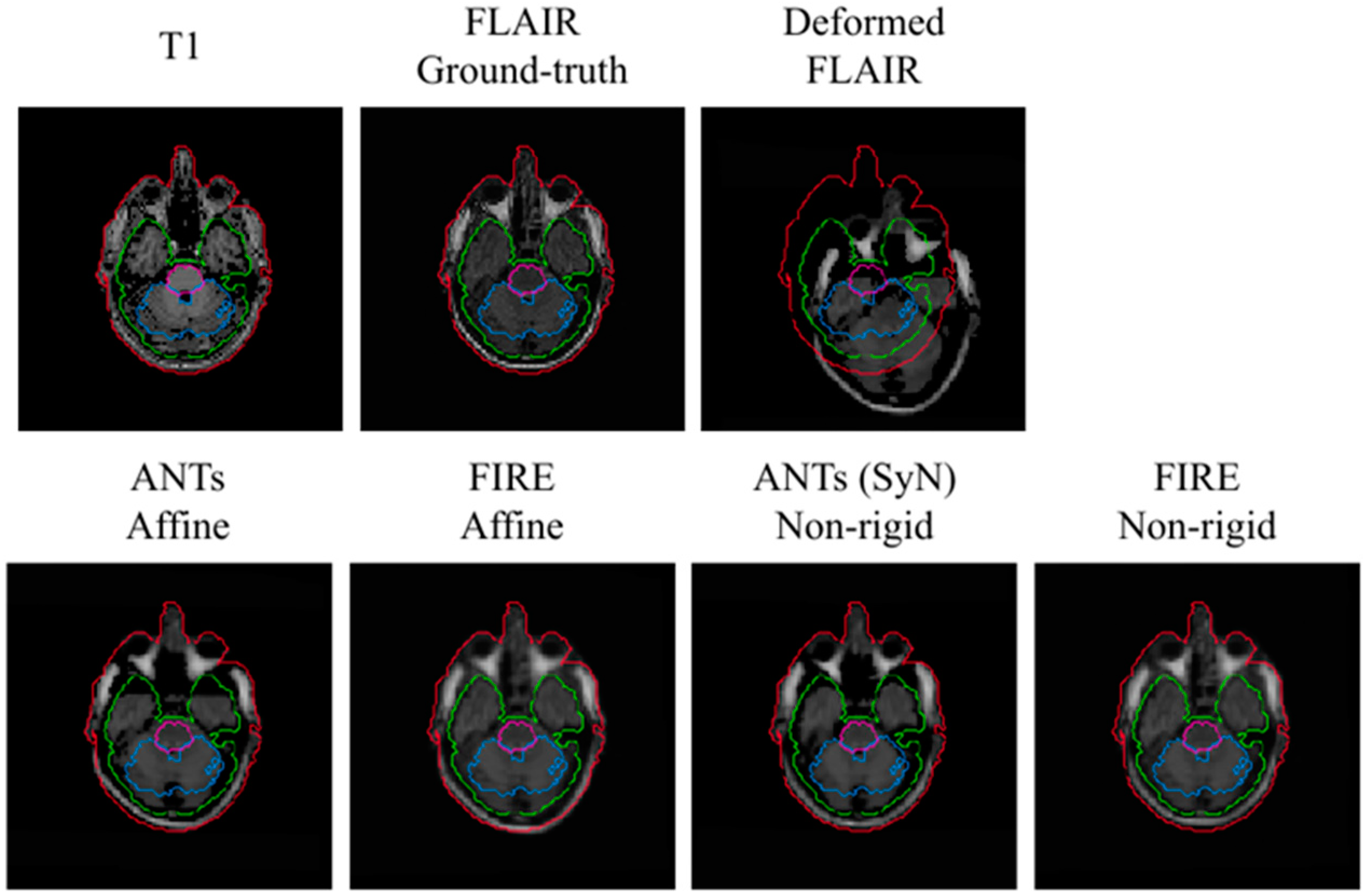 Unsupervised Image Registration towards Enhancing Performance and Explainability in Cardiac and ...