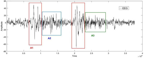 Sensors | Free Full-Text | Automatic Detection of the Cyclic Alternating Pattern of Sleep and ...