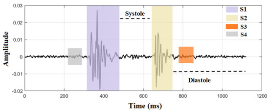 Sensors | Free Full-Text | The Effect of Signal Duration on the Classification of Heart Sounds ...