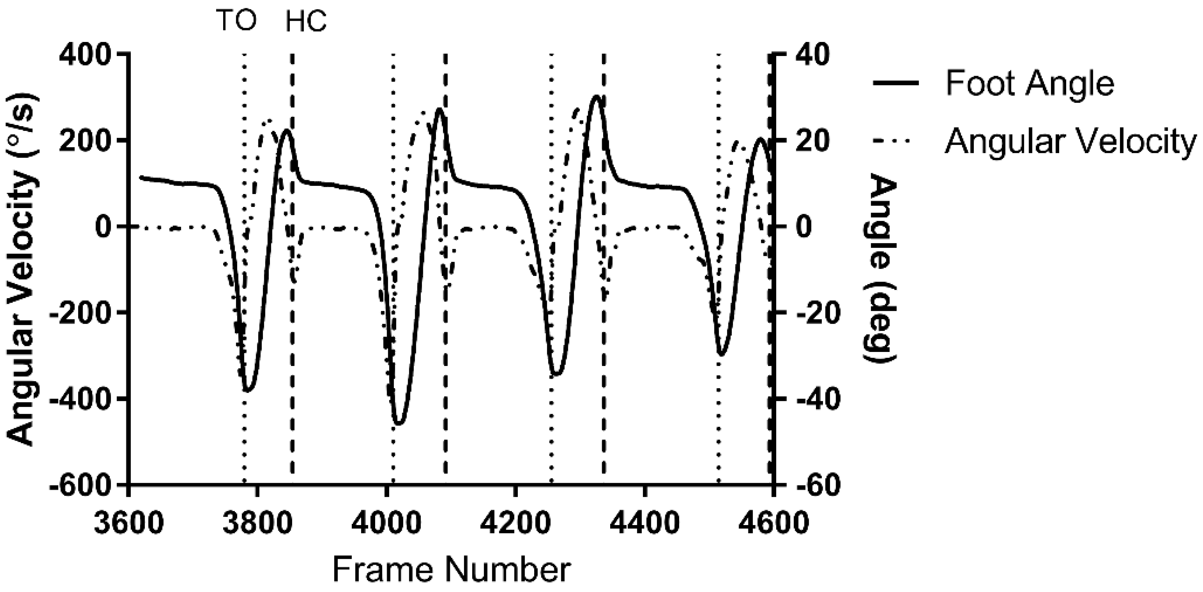 Development and Evaluation of a Slip Detection Algorithm for Walking on ...