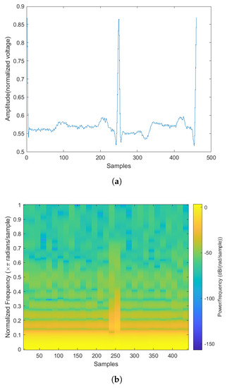 Sensors | Free Full-Text | Structural Anomalies Detection from ...