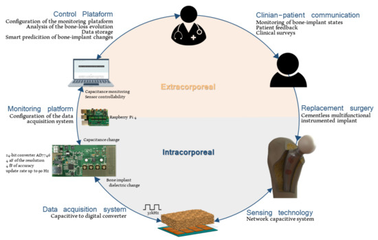 Multiscale Sensing of Bone-Implant Loosening for Multifunctional Smart ...