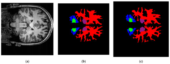 Deep 3D Neural Network for Brain Structures Segmentation Using Self-Attention Modules in MRI Images