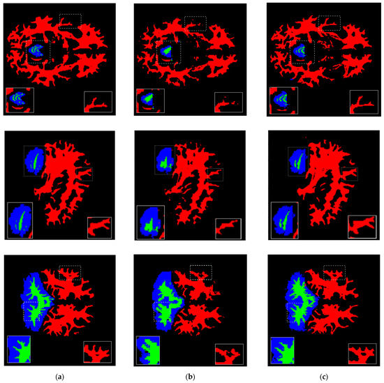 Deep 3D Neural Network for Brain Structures Segmentation Using Self ...