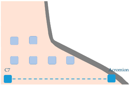 Scapular Dynamic Muscular Stiffness Assessed through Myotonometry: A ...