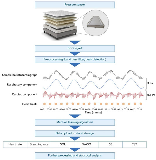 Performance Evaluation of a Smart Bed Technology against Polysomnography