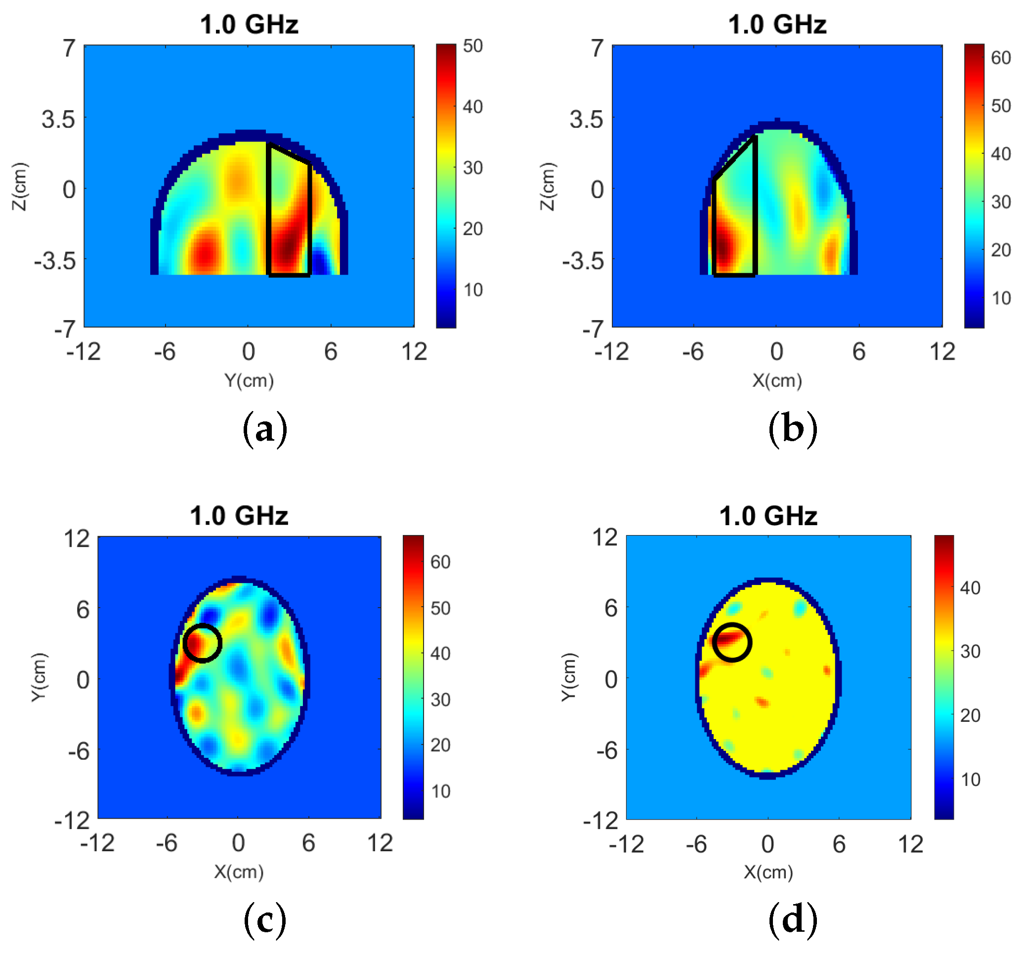 Three-Dimensional Microwave Head Imaging with GPU-Based FDTD and the DBIM Method