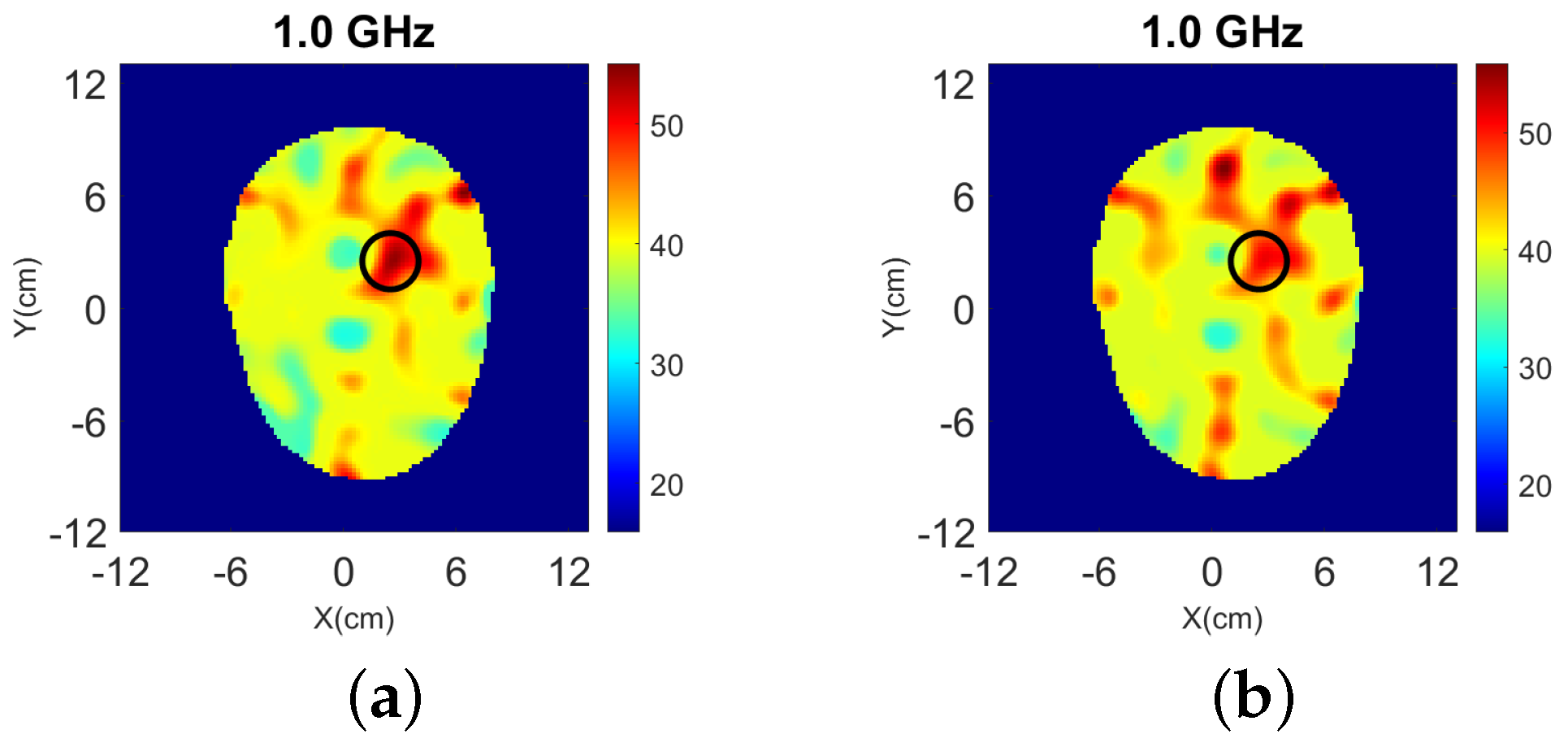 Three-Dimensional Microwave Head Imaging with GPU-Based FDTD and the DBIM Method