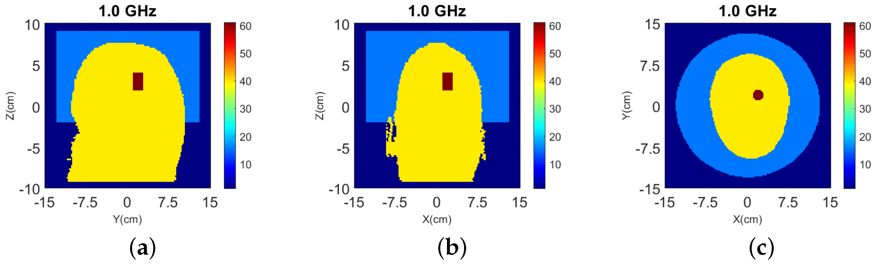 Three-Dimensional Microwave Head Imaging with GPU-Based FDTD and the DBIM Method
