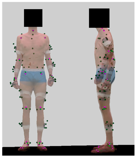 Pose2Sim: An End-to-End Workflow for 3D Markerless Sports Kinematics—Part 2: Accuracy