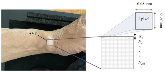 Quantification and Visualization of Reliable Hemodynamics Evaluation ...