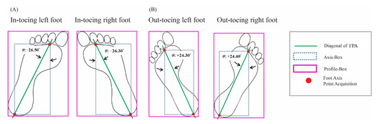 A Deep Learning Method for Foot Progression Angle Detection in Plantar ...