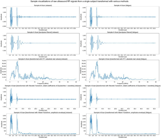 Classifying Muscle States with One-Dimensional Radio-Frequency Signals ...