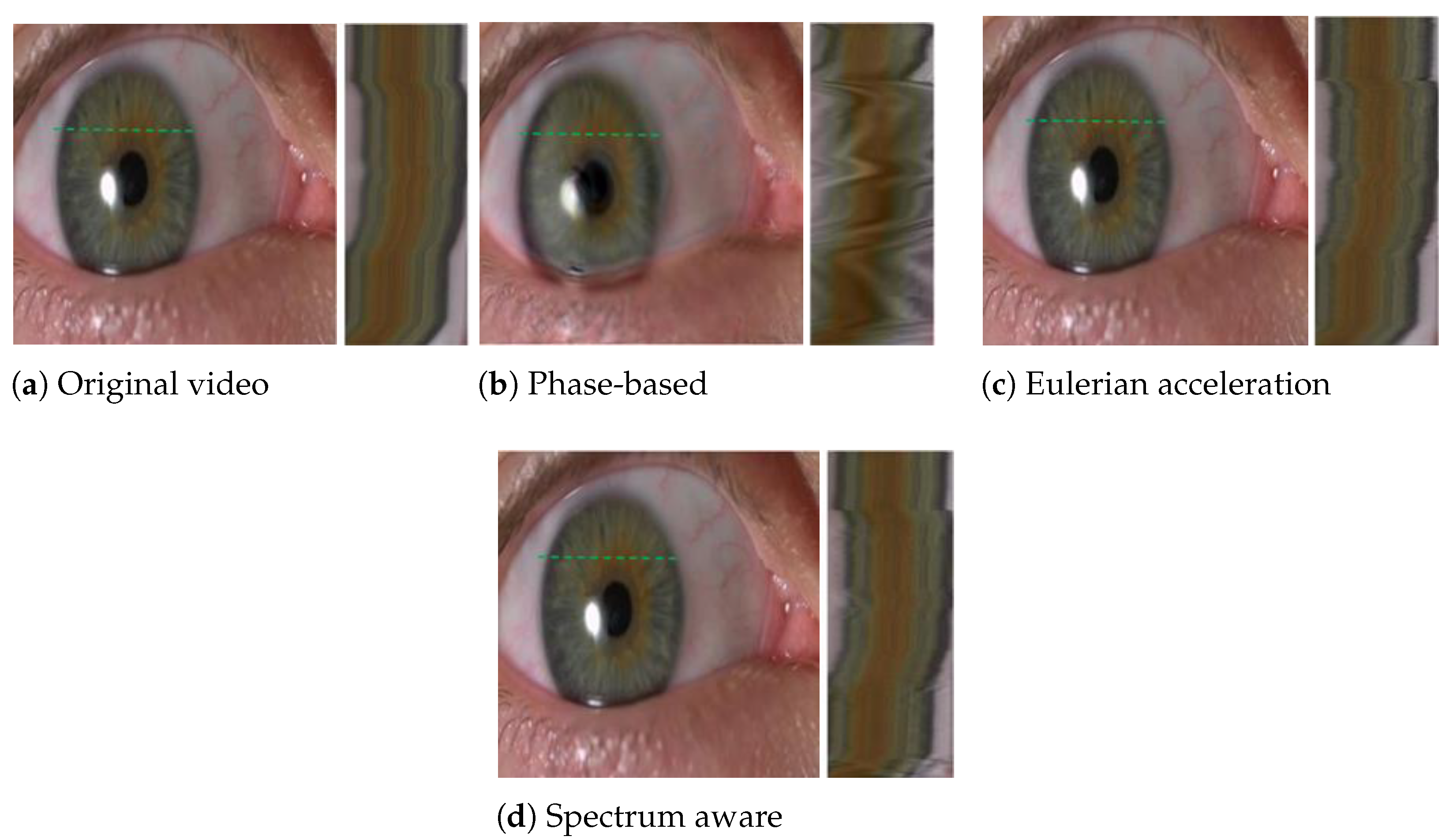 Sensors | Free Full-Text | Bayesian-Inference Embedded Spline-Kerneled Chirplet Transform for ...