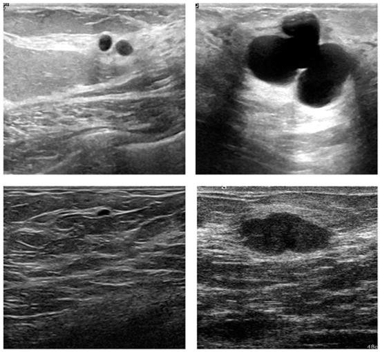 Super-Resolution Ultrasound Imaging Scheme Based on a Symmetric Series ...