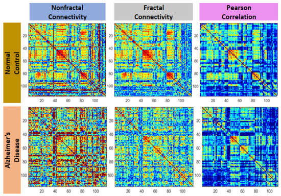 Wavelet-Based Fractal Analysis of rs-fMRI for Classification of Alzheimer’s Disease
