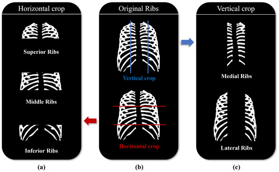 Segmentation Performance Comparison Considering Regional ...