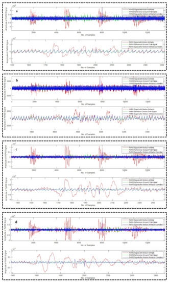 Sensors | Free Full-Text | Motion Artifacts Correction from Single-Channel EEG and fNIRS Signals ...
