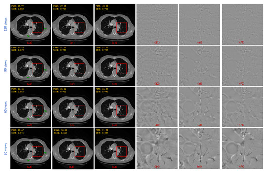 Sparse View Ct Reconstruction Based On A Hybrid Domain Model With Multi Level Wavelet Transform