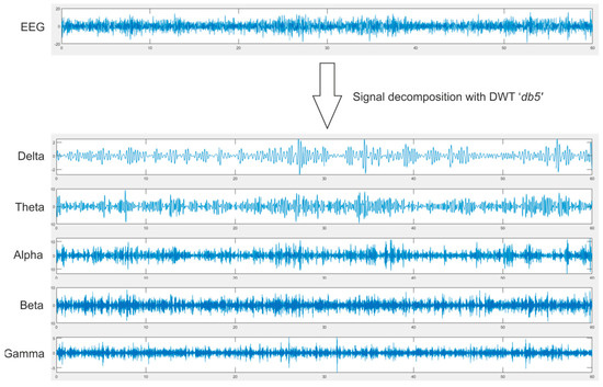 Emotion Recognition Using a Reduced Set of EEG Channels Based on ...