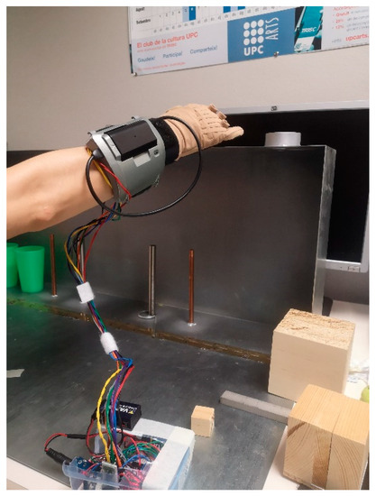 Hand Motion Analysis during the Execution of the Action Research Arm ...