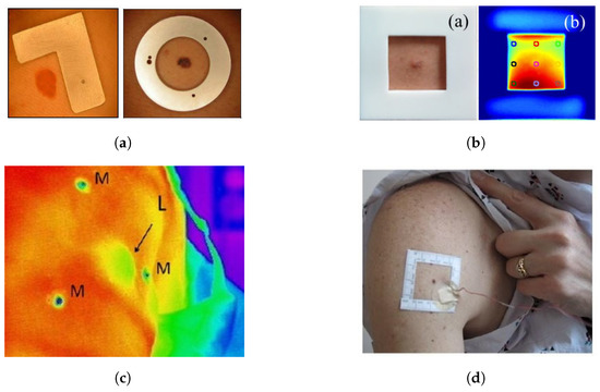 Sensors | Free Full-Text | Skin Cancer Detection Using Infrared ...
