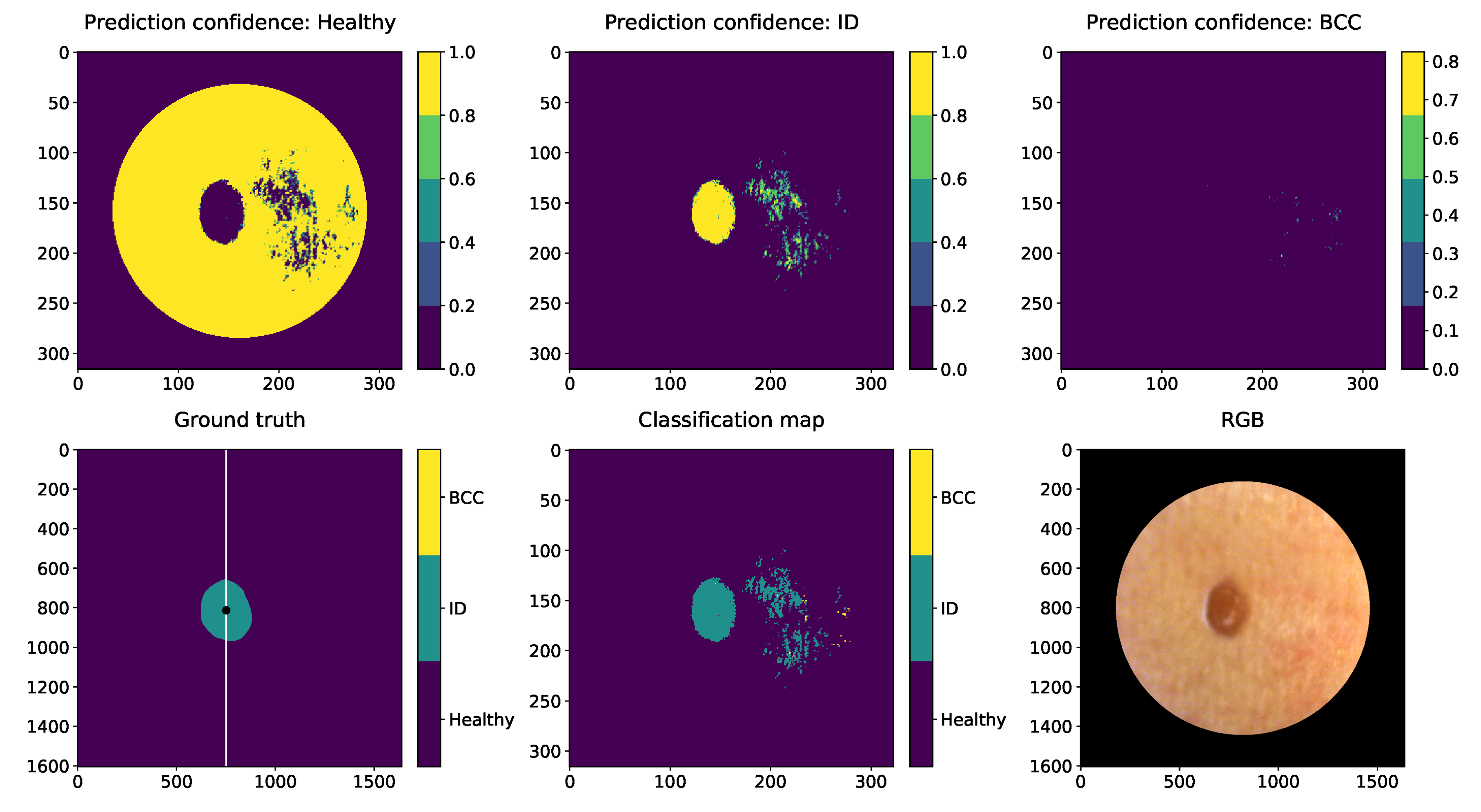 FPI Based Hyperspectral Imager for the Complex Surfaces—Calibration ...