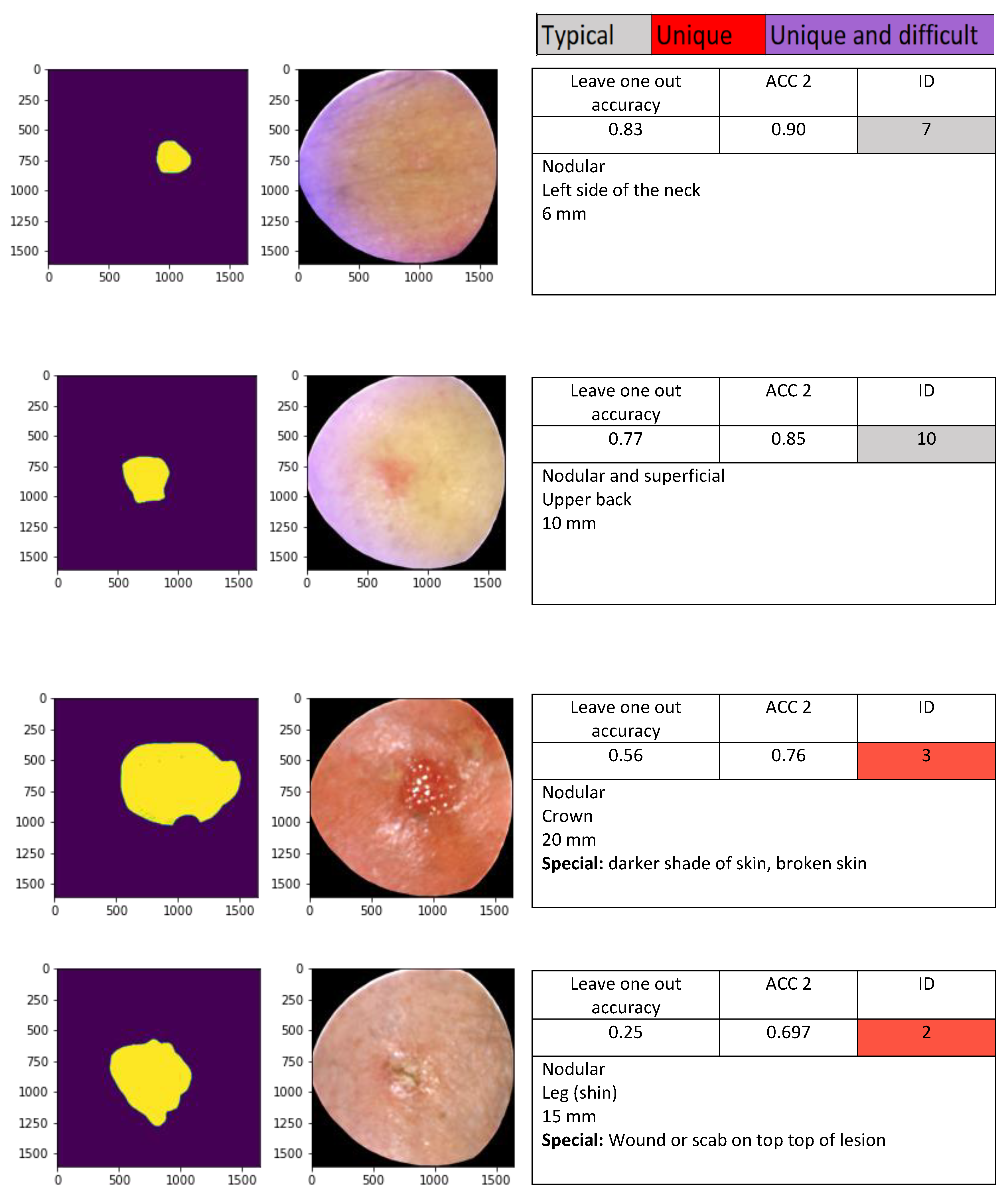 FPI Based Hyperspectral Imager for the Complex Surfaces—Calibration ...