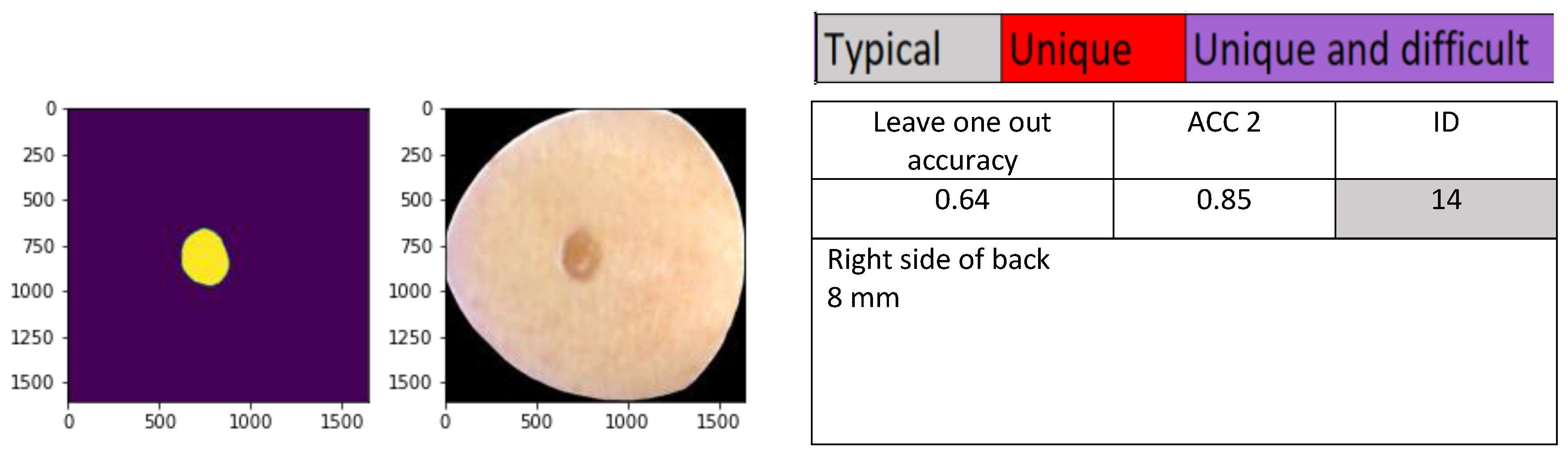 FPI Based Hyperspectral Imager for the Complex Surfaces—Calibration ...