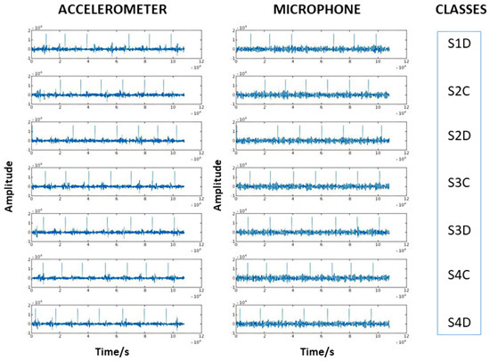 Sensors | Free Full-Text | Modeling and Fault Detection of Brushless Direct Current Motor by ...