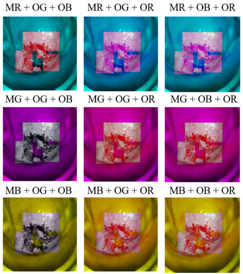 RGB Channel Superposition Algorithm with Acetowhite Mask Images in a ...