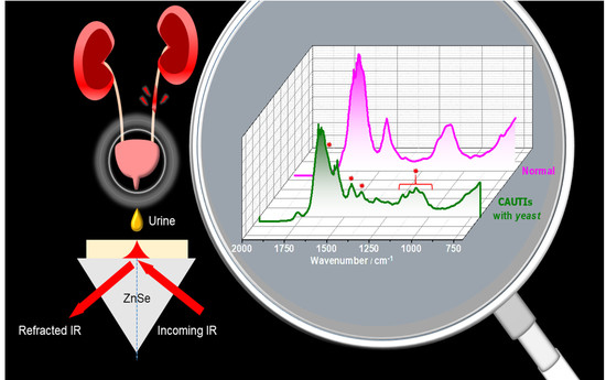 Sensors | Special Issue : Recent Advancements in Sensor Technologies ...
