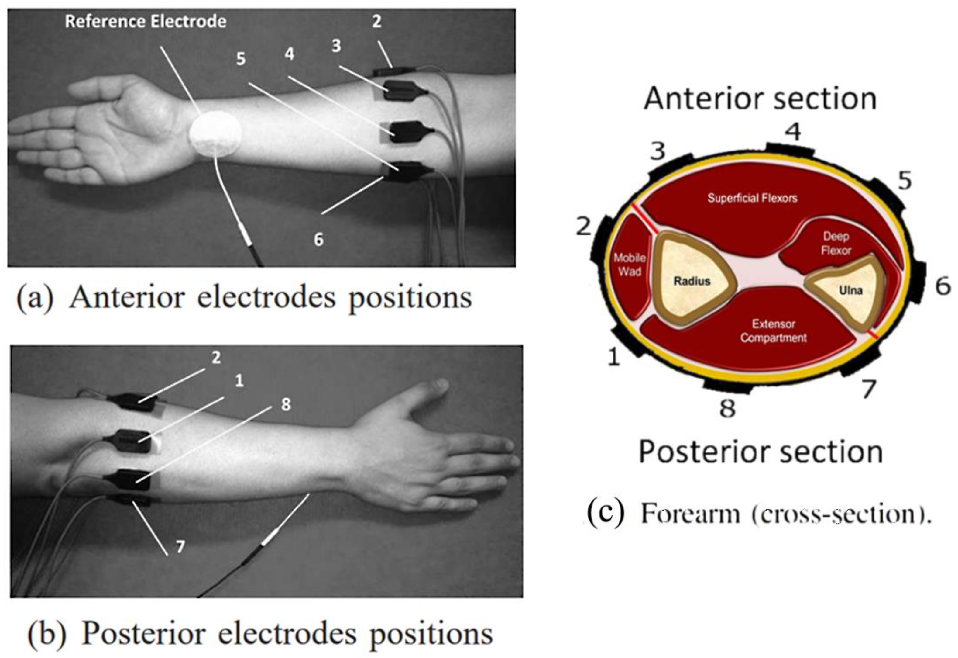 Sensors | Free Full-Text | Applying Machine Learning to Finger ...