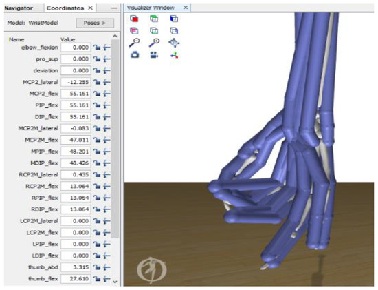 Sensors | Free Full-Text | Applying Machine Learning to Finger ...
