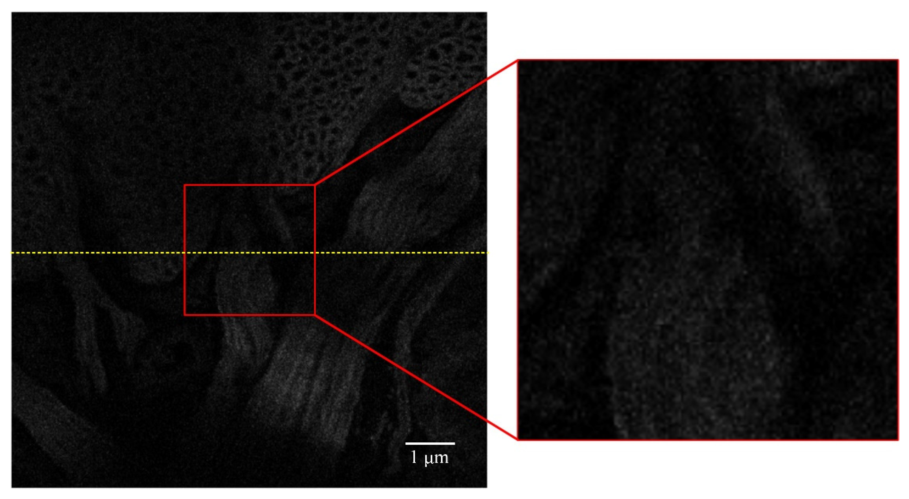 Sensors | Free Full-Text | Active Aberration Correction with Adaptive Coefficient SPGD Algorithm ...