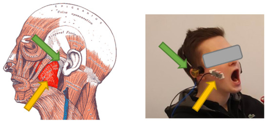 sEMG and Vibration System Monitoring for Differential Diagnosis in ...