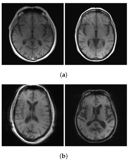 Multi-Domain Neumann Network with Sensitivity Maps for Parallel MRI ...